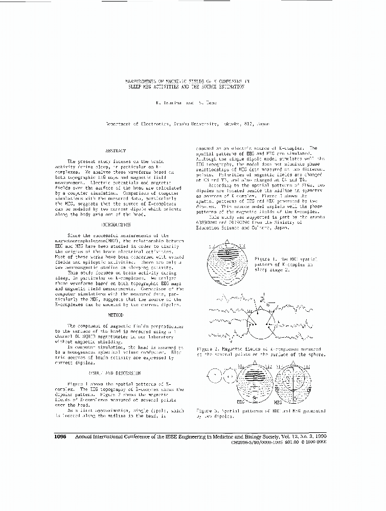Measurements Of Magnetic Fields Of K-complexes In Sleep MEG Activities ...